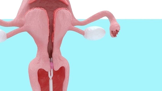 Animated Uterus and Mirena IUD Animable 3d model