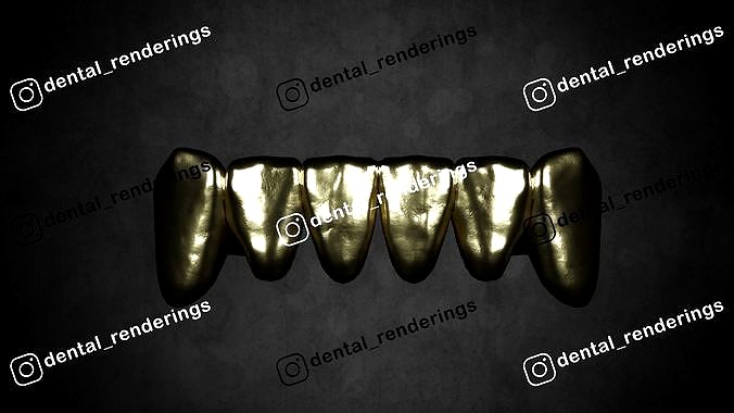 Lower Grillz - gold teeth 3d model