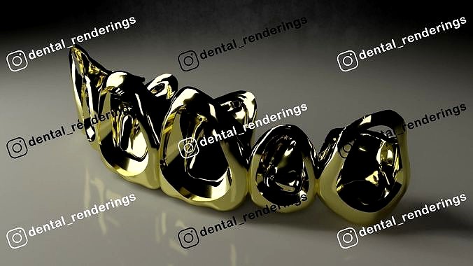 Grillz - gold teeth 3d model