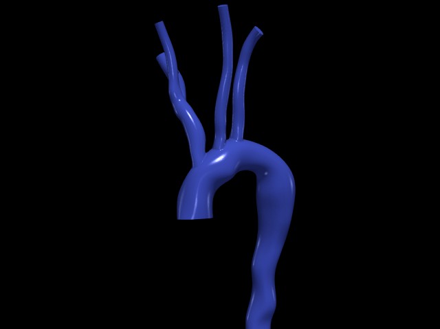 Aorta 3d model