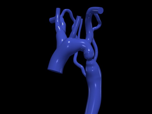 Aorta 3d model