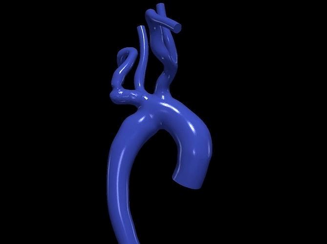3d model of aorta | 3D