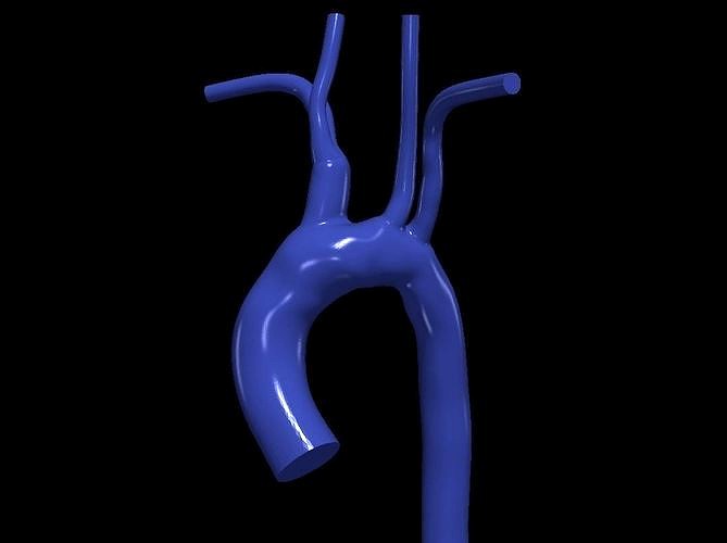 3d model of aorta | 3D