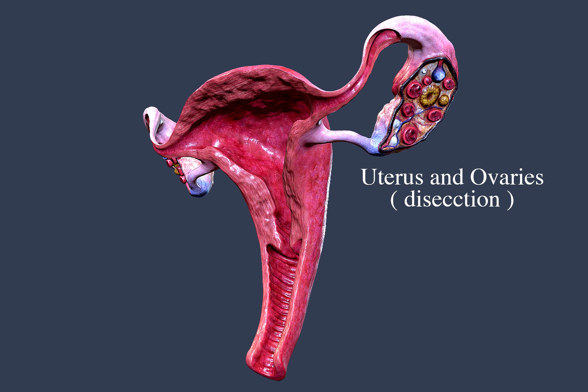 Uterus and Ovaries dissection 3d model