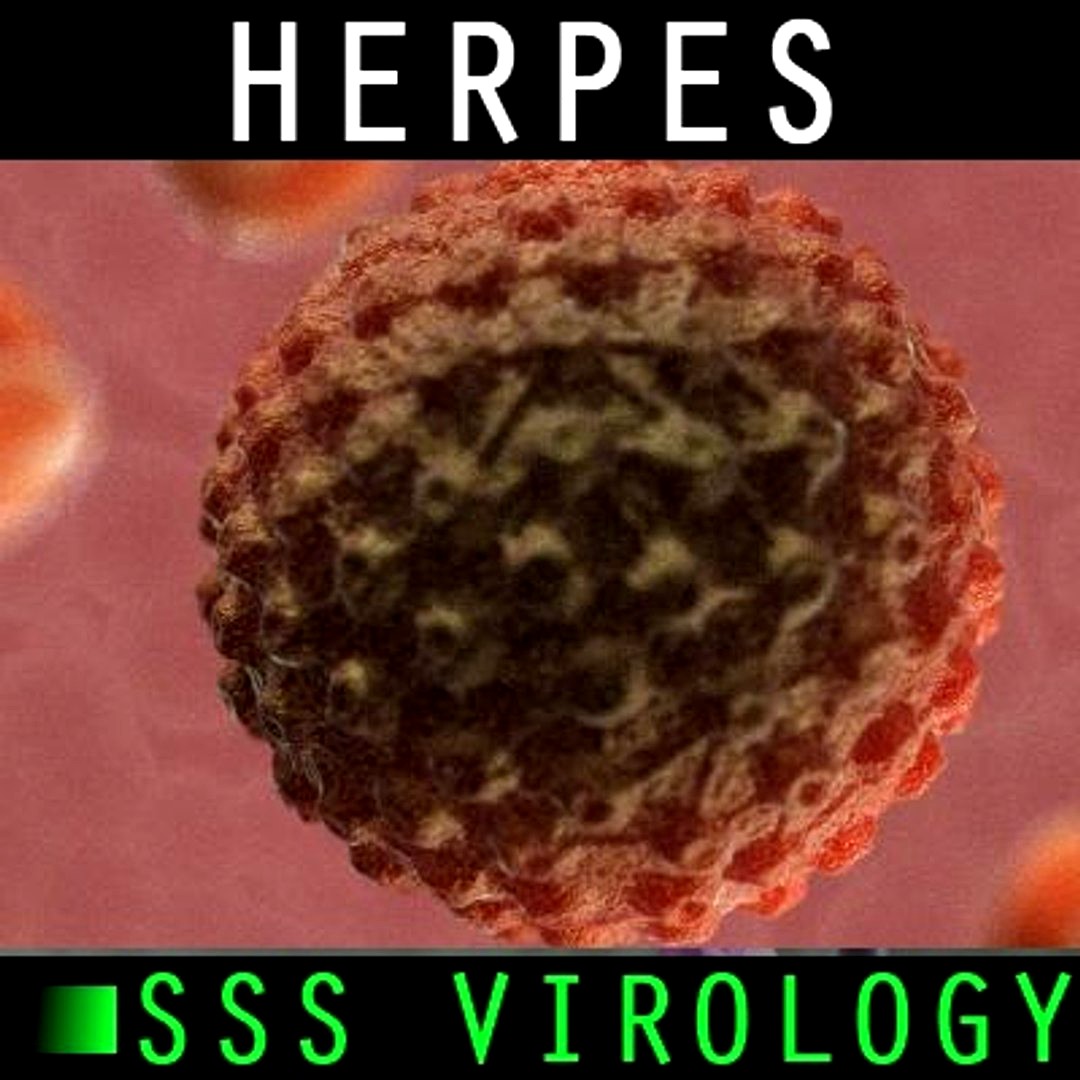 SSS Herpes Simplex HD 3d model