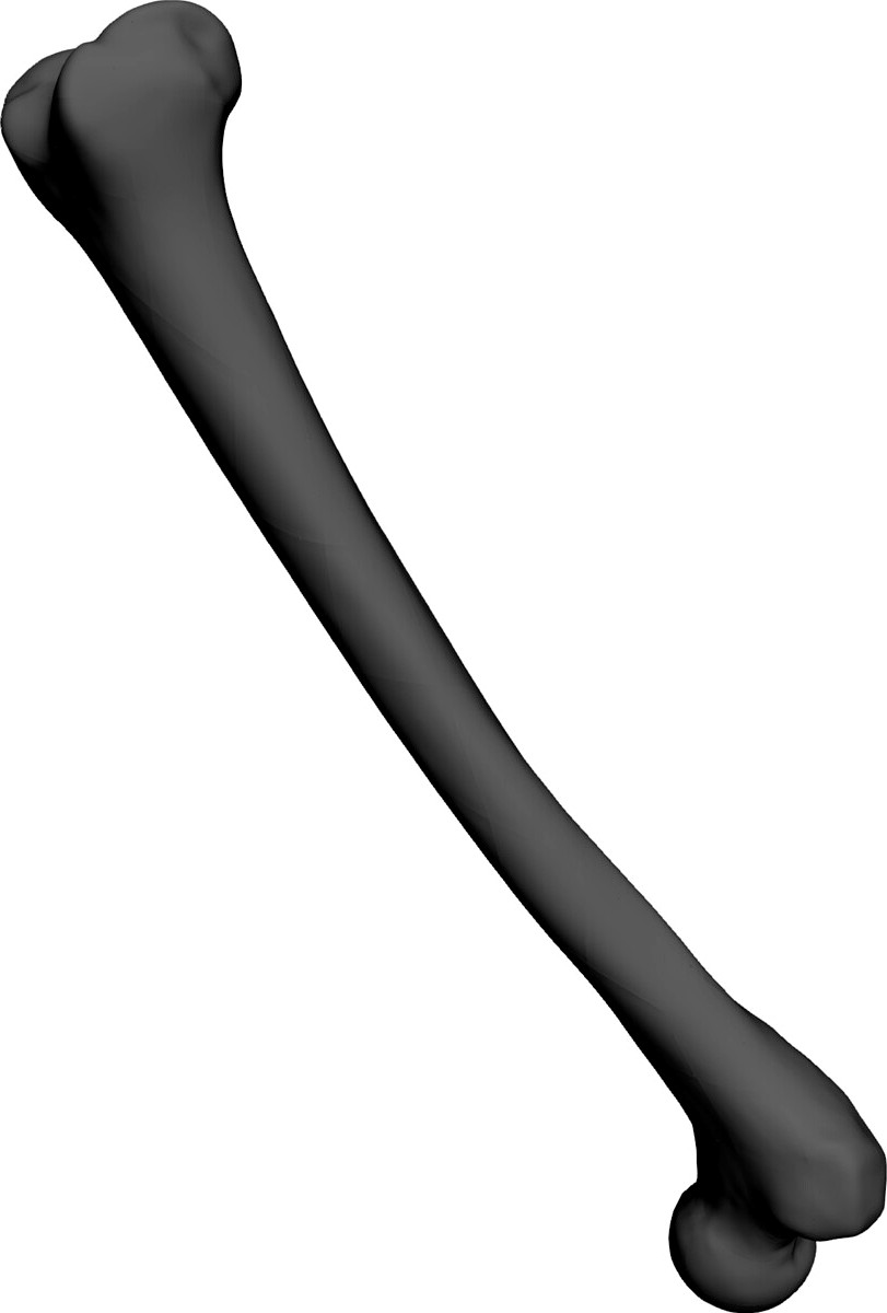 Femur Bone 3D CAD Model