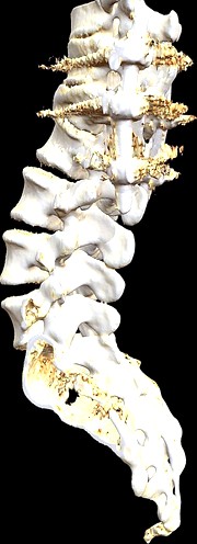 Female spine installation | 3D model