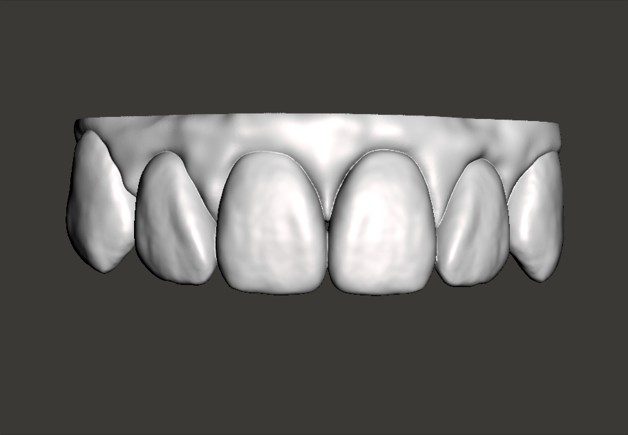 Dental model. Up front teeth part. (Ready to print) 3d
